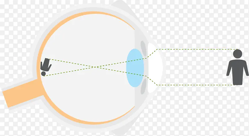 扁平眼睛视力检测PNG图片素材下载_图片编号yormmxkq-免抠素材网